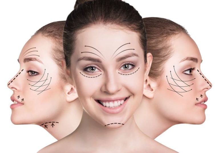 Facelifting Behandlungsmethoden in Kombination & Trends
